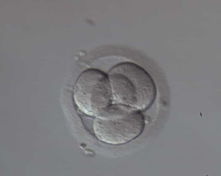 A második nap – Asszisztált Reprodukciós Osztály