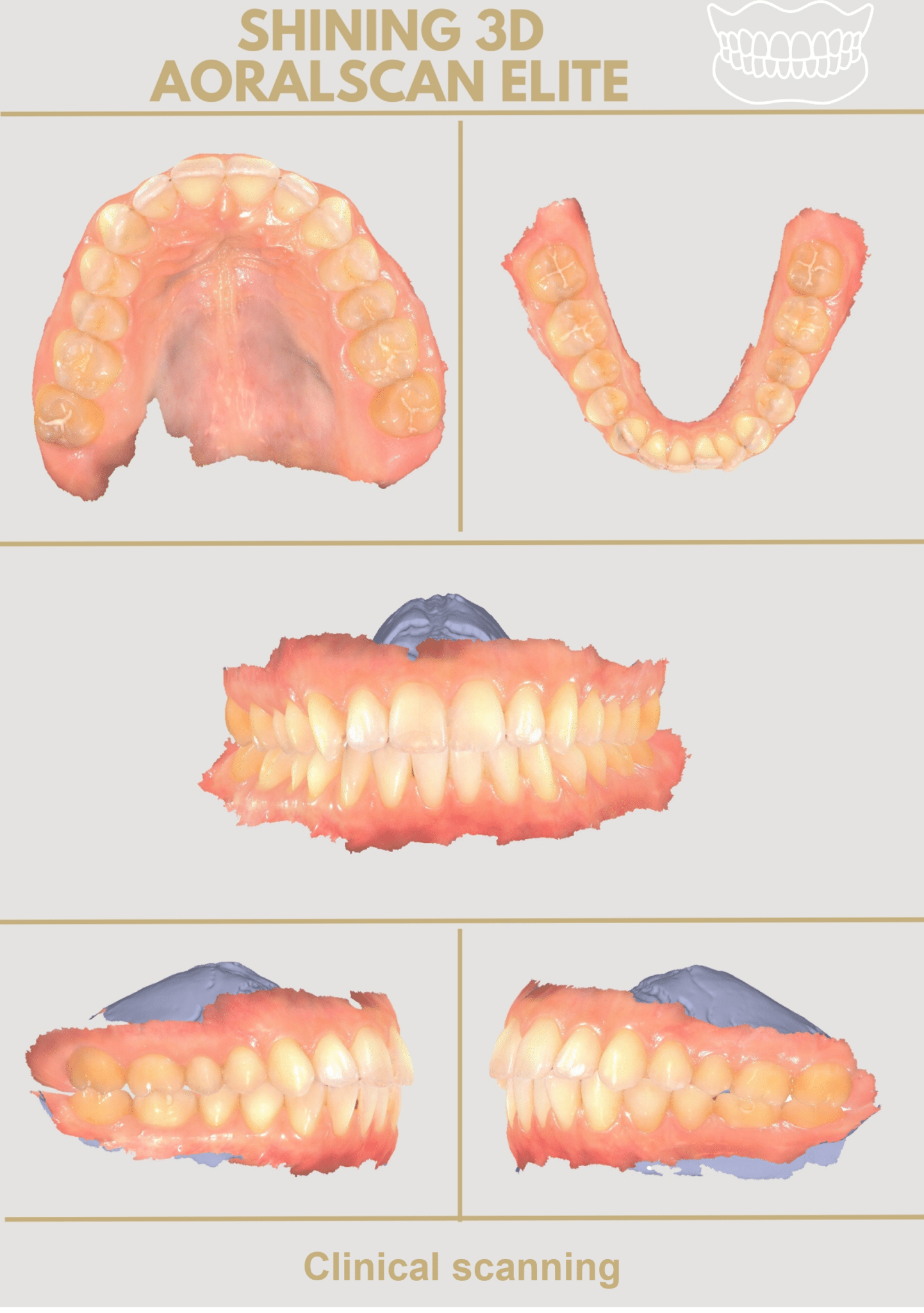 Shining 3D – Intraoral scanners