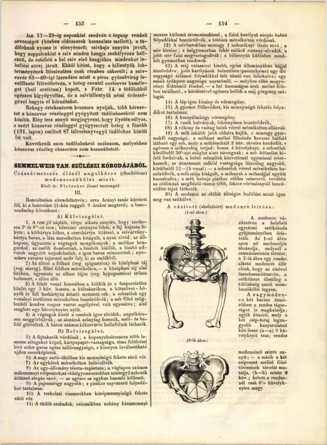 Ignac Semmelweis – Semmelweis University