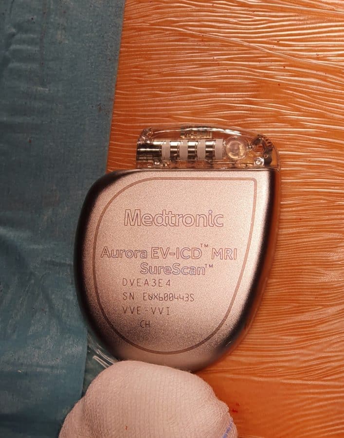 A newly developed device prevents sudden cardiac death at Semmelweis ...