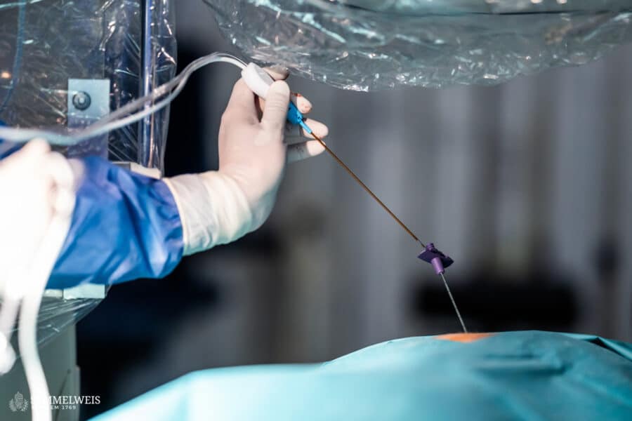 Single-puncture surgery on a patient with metastatic spinal tumor at ...