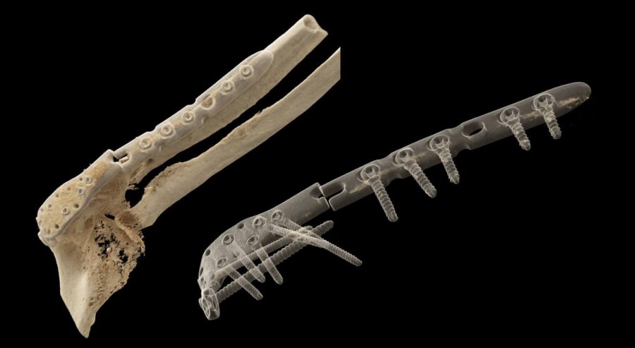 The world’s most advanced CT scanner was inaugurated at Semmelweis ...