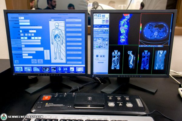 Világszínvonalú nanoScan SPECT-CT az egyetemen – Semmelweis Hírek Világszínvonalú nanoScan SPECT-CT az egyetemen – Semmelweis Hírek