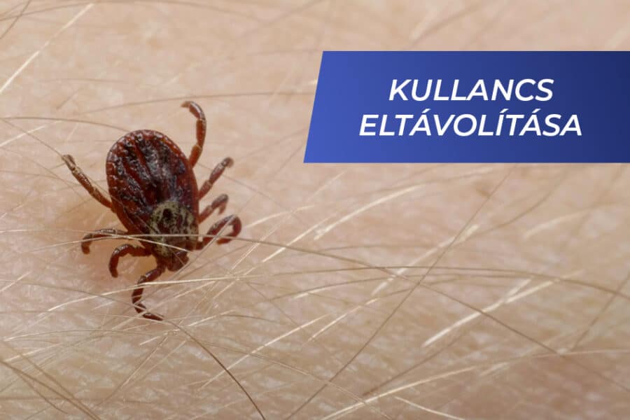 Tények és tévhitek a kullancs helyes eltávolításáról – VIDEÓVAL ...